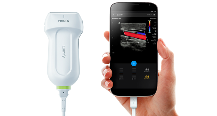 Philips Ultrasound Machines