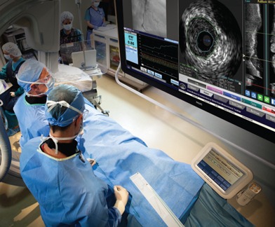 Peripheral IVUS - Intravascular Ultrasound | Philips Healthcare