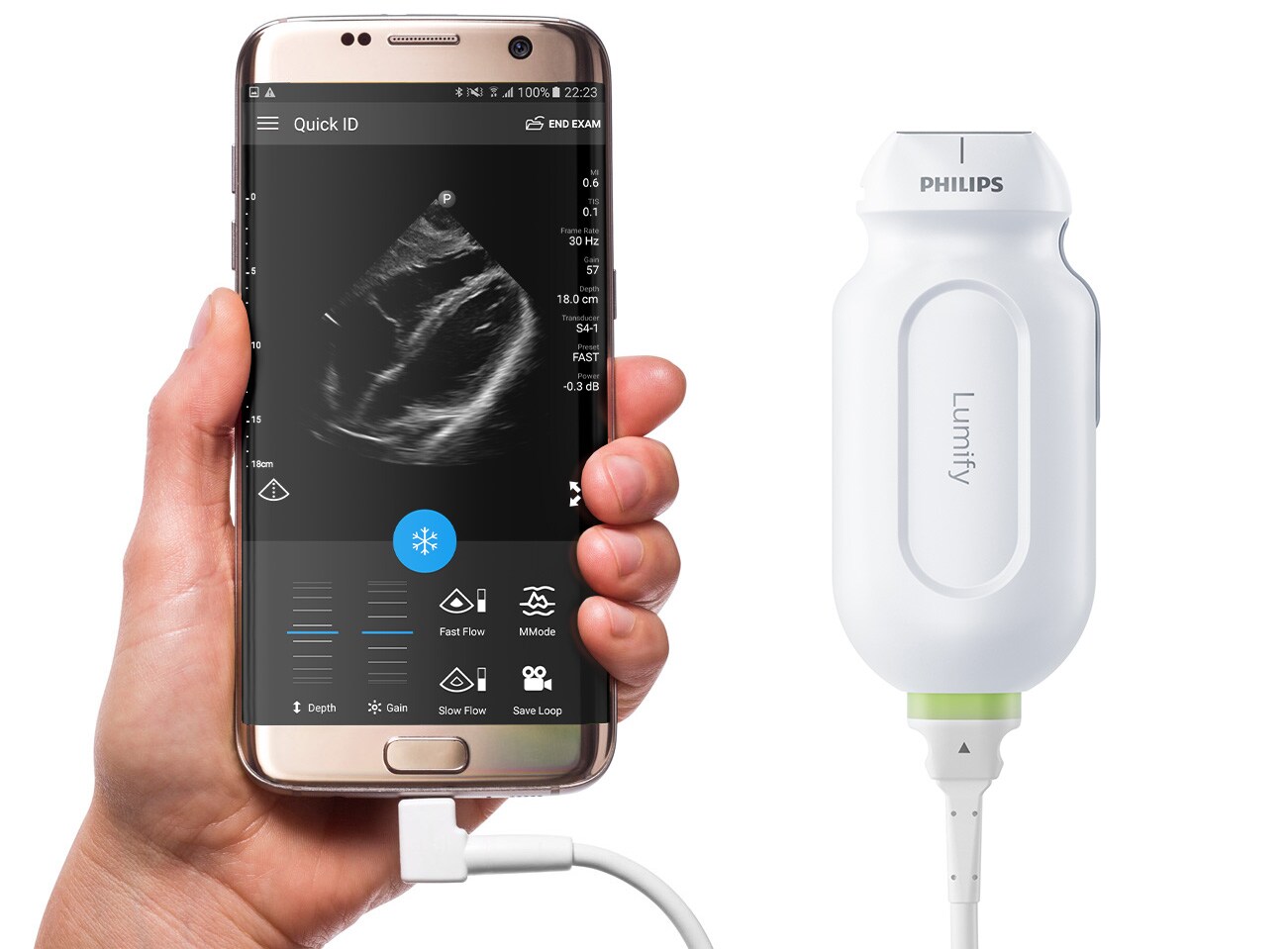 Lumify for Cardiac Imaging | Philips Healthcare