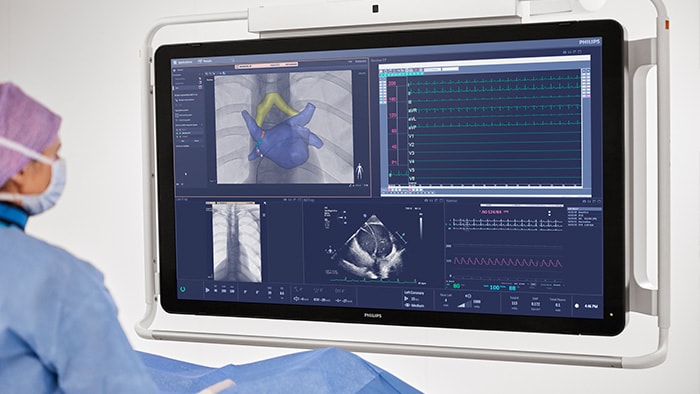 Electrophysiology | Philips