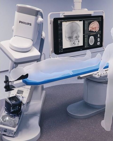 Azurion Biplane Image Guided Therapy System | Philips