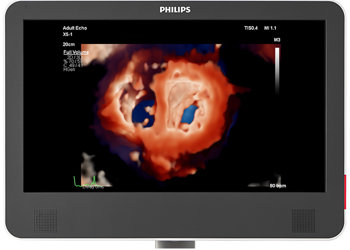 Changing to meet your challenges | Philips