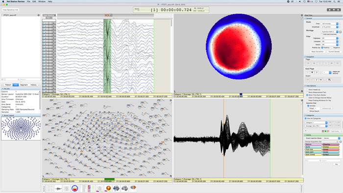 Easy eeg software download - castingero
