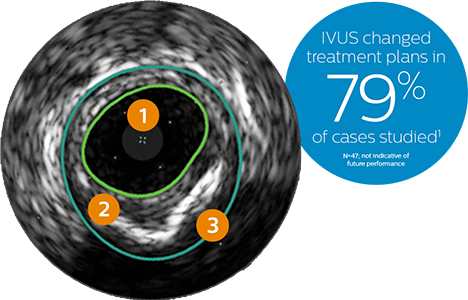 See clearly. Treat optimally. | Philips Healthcare