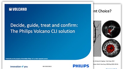 Peripheral arterial disease (PAD) educational resources | Philips