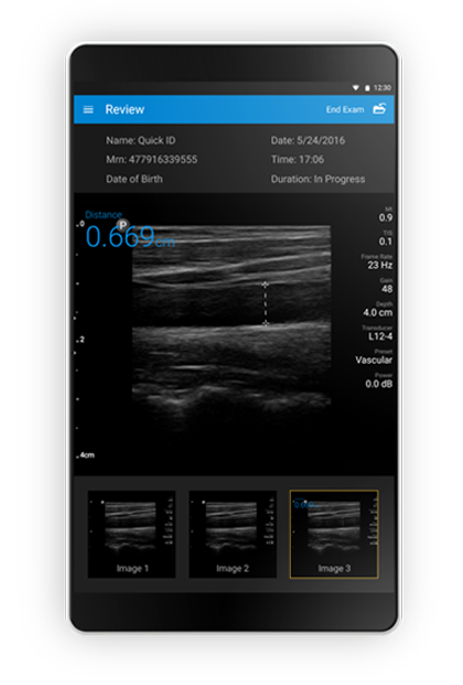 Lumify ultrasound app | Philips Healthcare