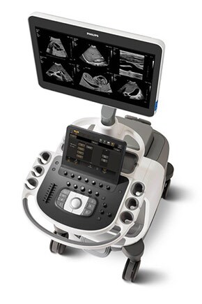 General Imaging Ultrasound machines | Philips Healthcare
