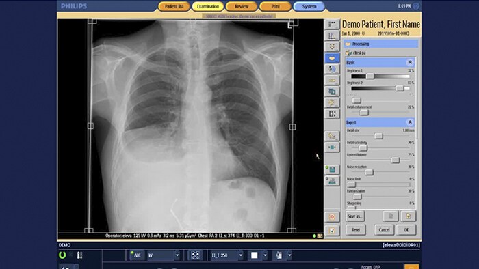 A smart pathway to the future | Philips