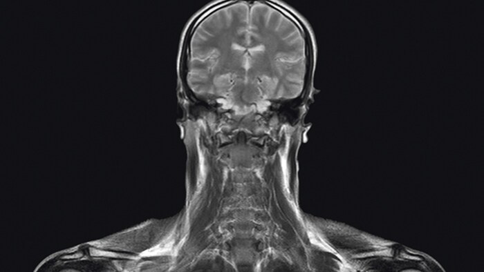 A smart pathway to the future with Philips MR | Philips