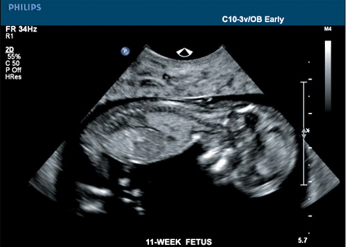 Your baby growth guide: the first trimester