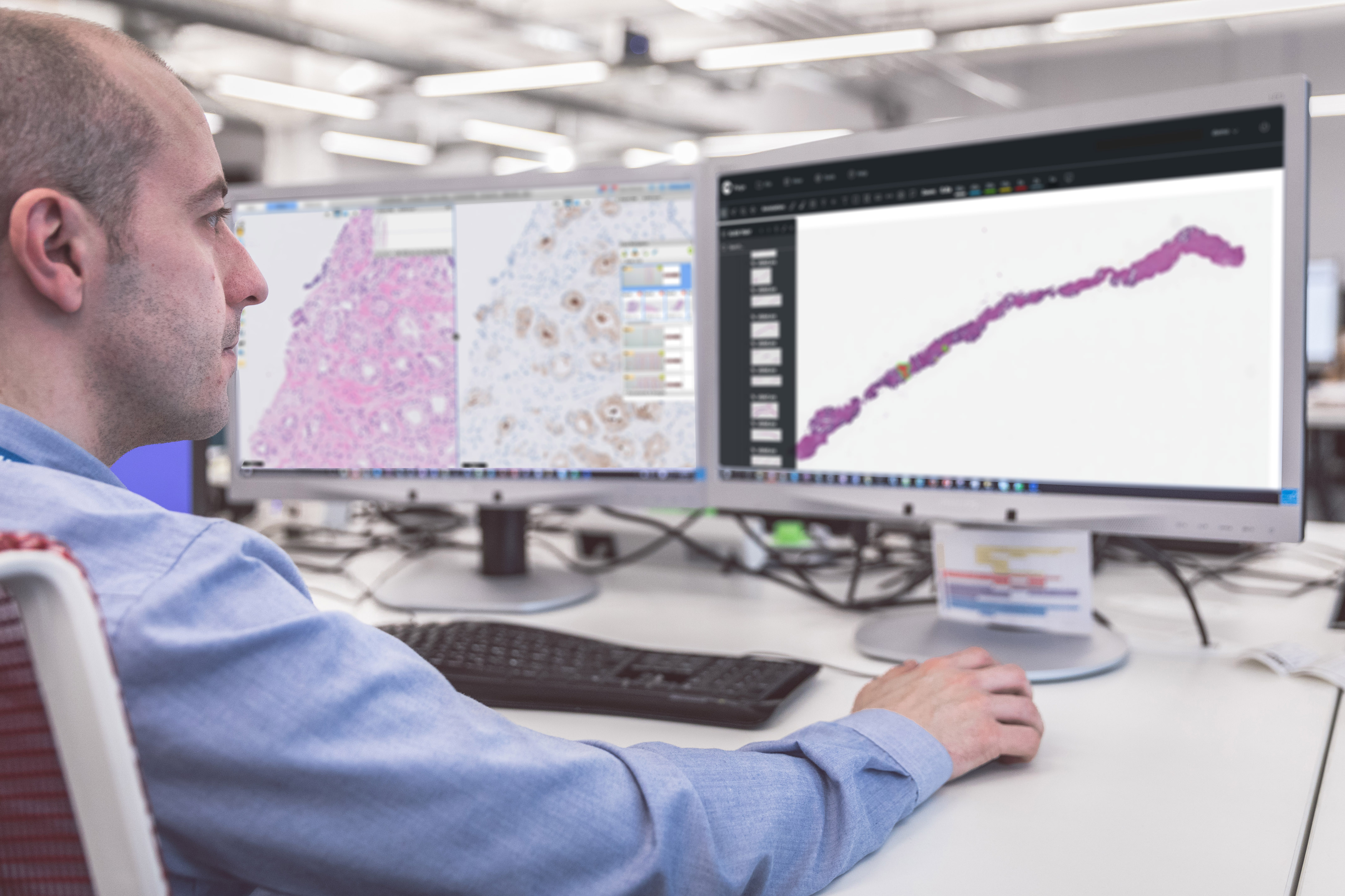 Philips and Paige bring AI to pathology - News | Philips