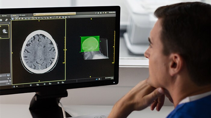 Philips introduces new Spectral CT 7500 - News | Philips