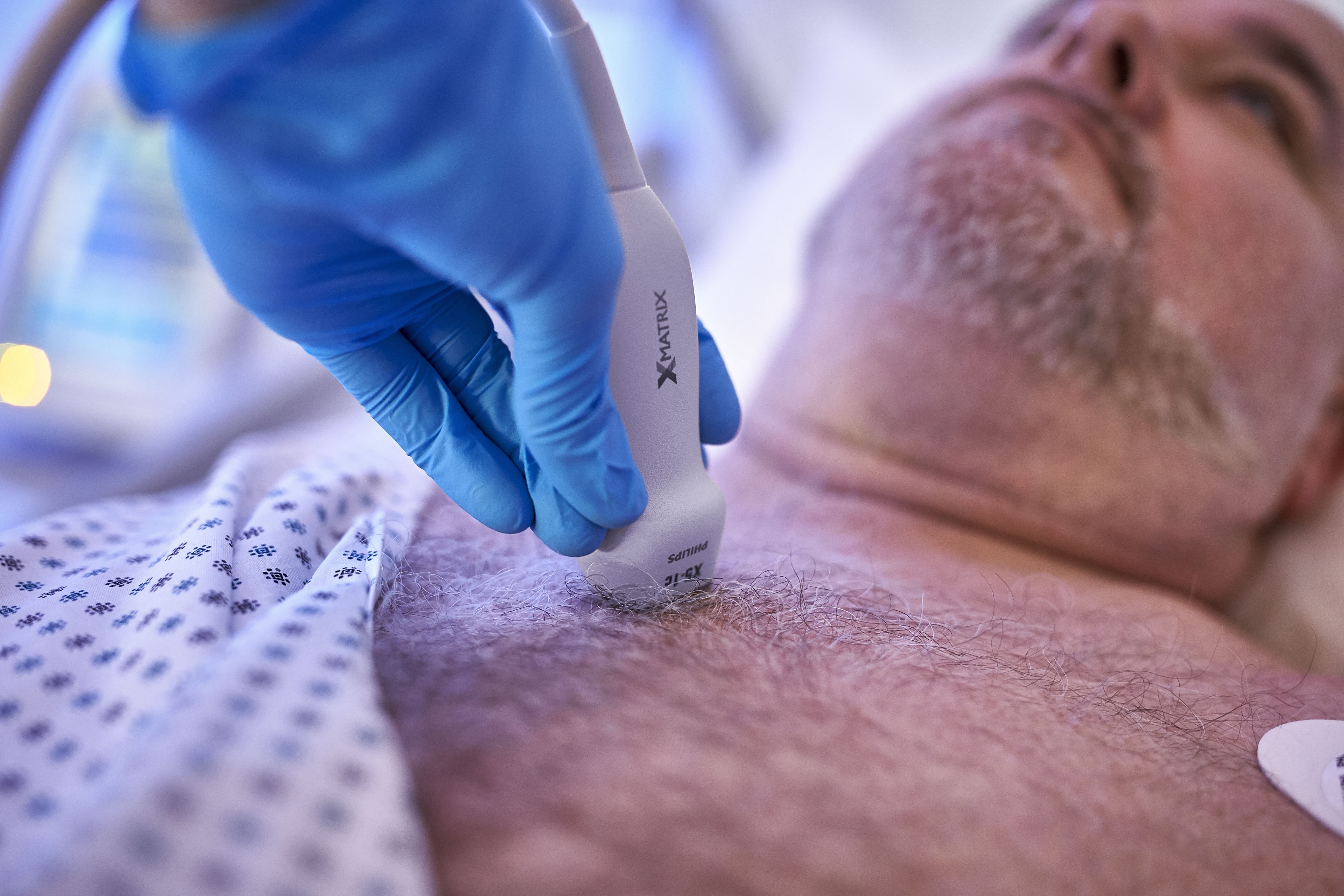 Philips expands ultrasound portfolio - News | Philips