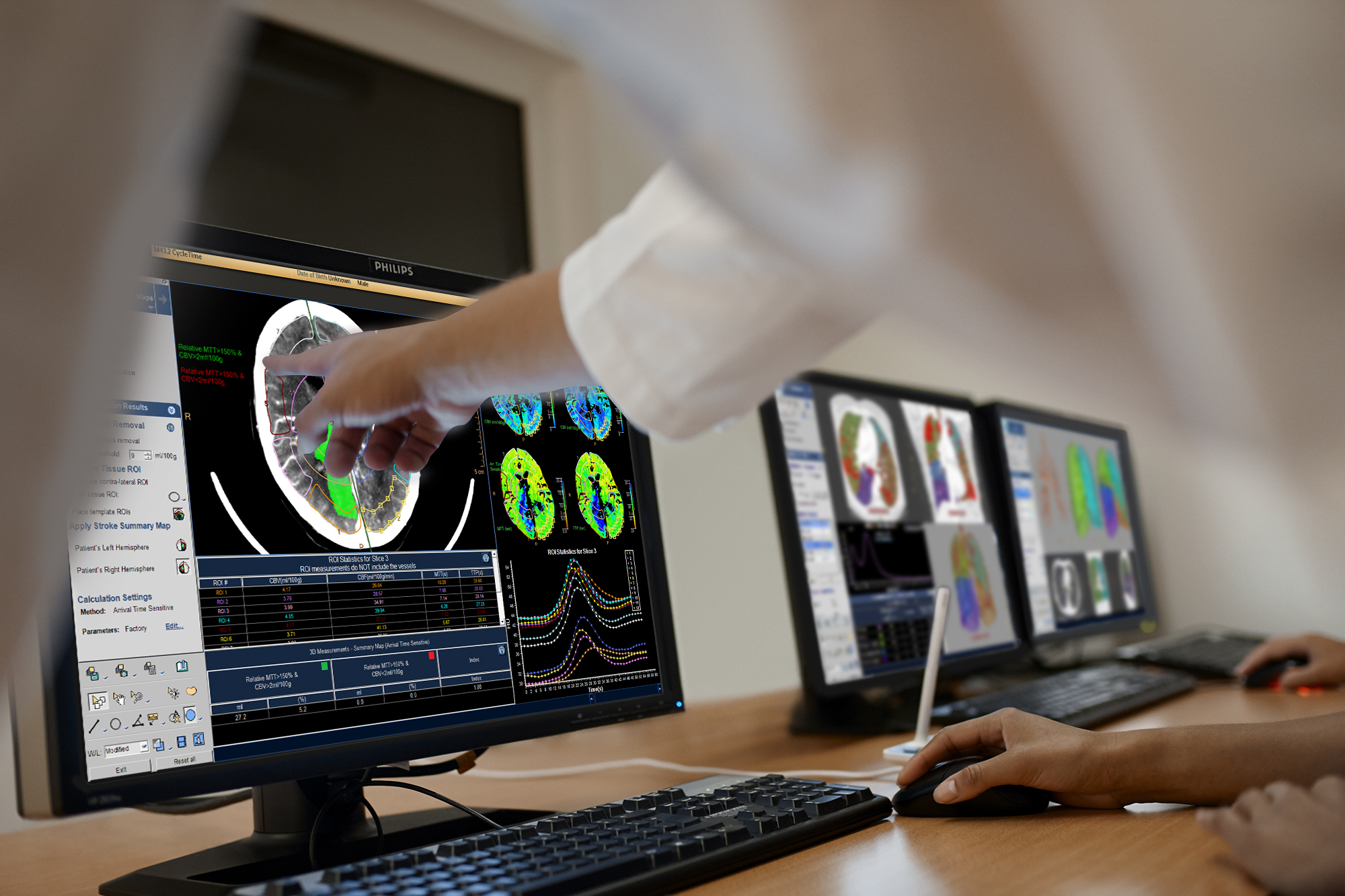 Philips debuts new AI-enhanced informatics solutions at RSNA - News | Philips