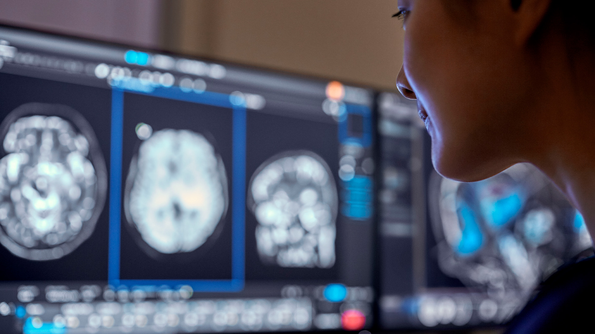 Philips unveil new AI-enabled imaging innovations at #RSNA - News | Philips
