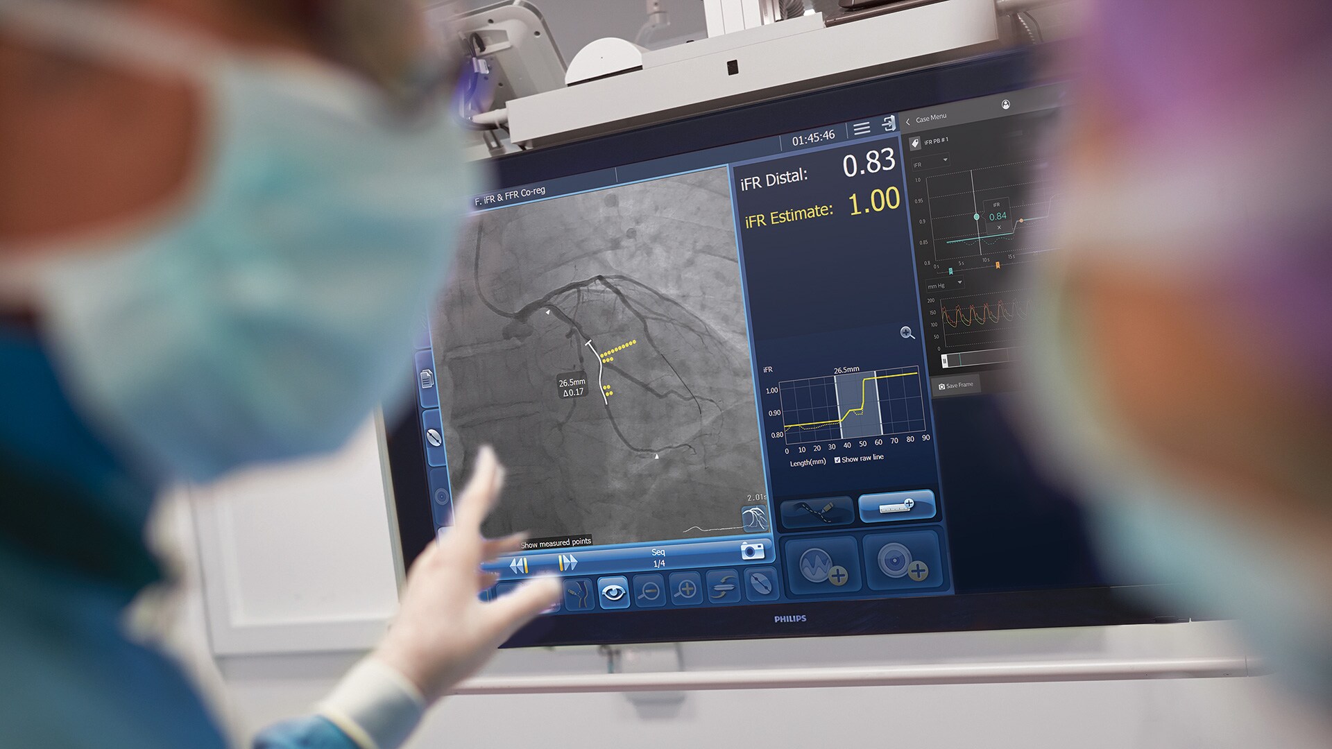 FDA clearance Philips Zenition 30 | Philips