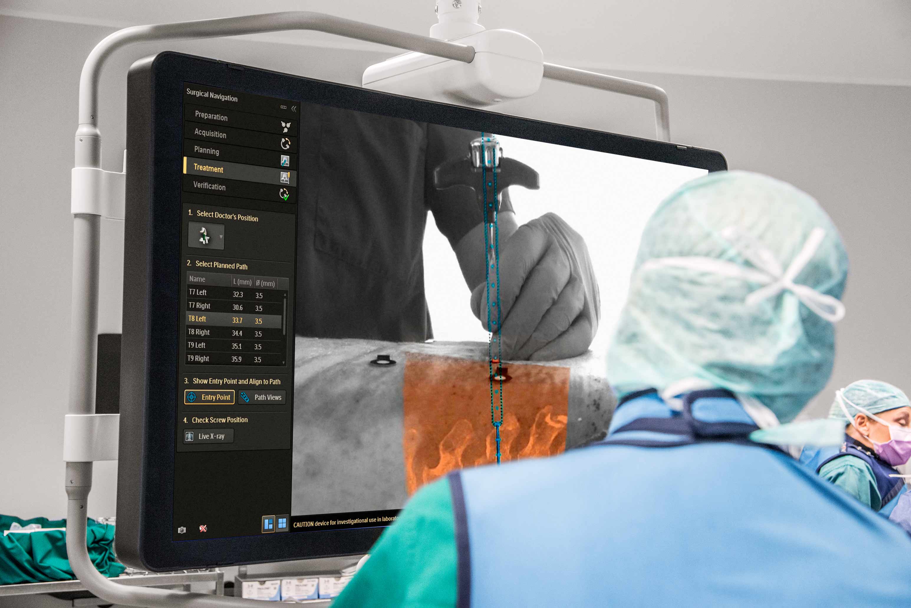 Philips announces new augmented-reality surgical navigation technology ... Philips announces new augmented-reality surgical navigation technology ...